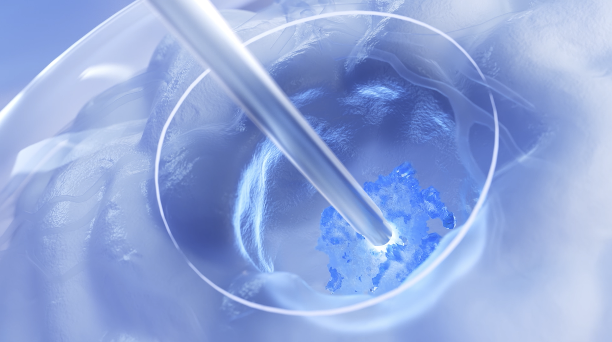 MONOMANGO | Zeiss Tumor Workflow